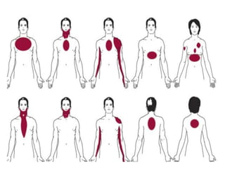 Chest Pain Location