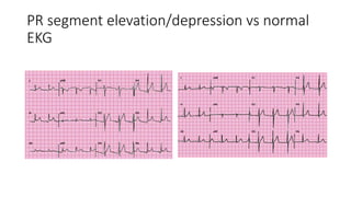 Chest pain | PPTX