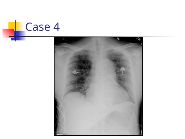 chest pain. Emergency department appraoch | PPT
