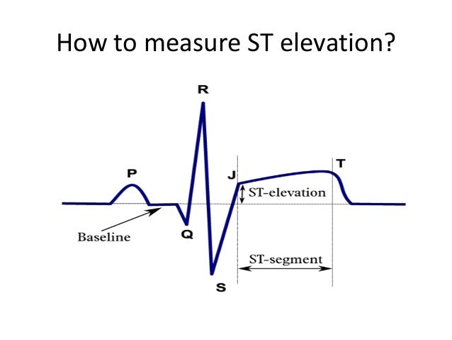 Chest pain structured approach