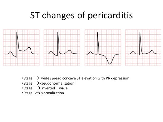 Chest pain structured approach