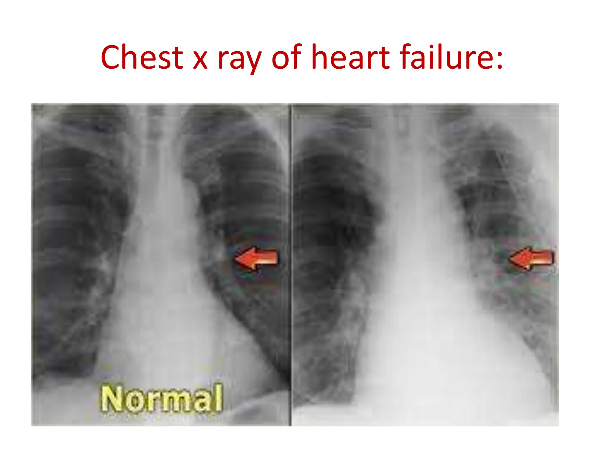 Differential diagnosis of chest pain .pptx