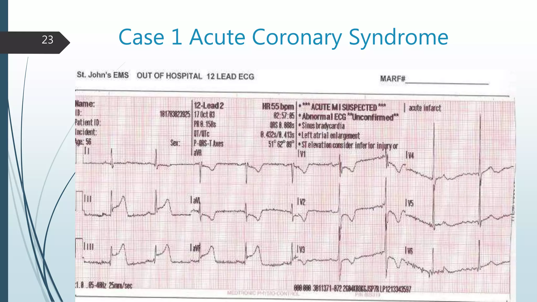 Chest pain Case Presentation with management | PPTX
