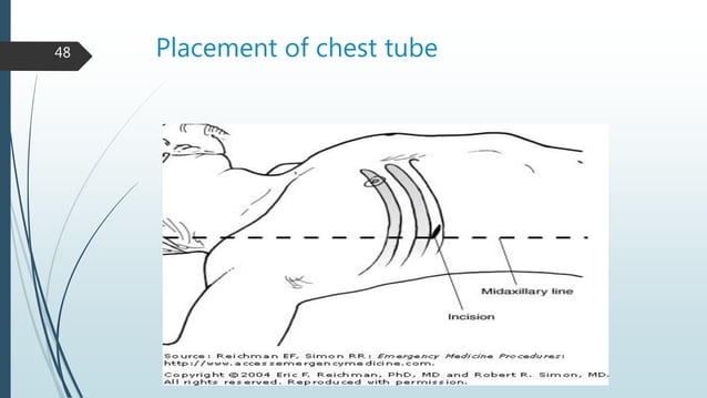 Chest pain Case Presentation with management | PPTX | Heart and ...