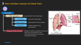 Chest Pain | PPTX