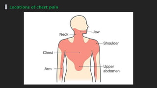 Chest Pain | PPTX