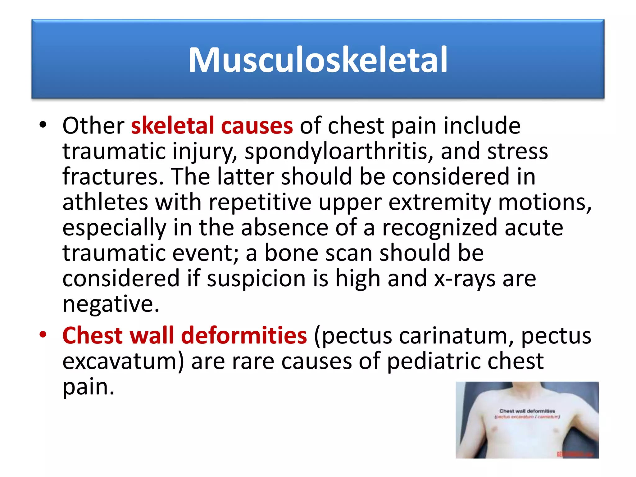 Chest pain in children | PPTX