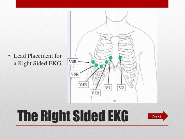 Chest pain scenario # 1_2015