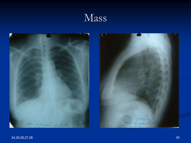 Chest Pathology.pptx