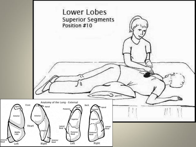 Chest Physiotherapy.. Dr.Padmesh | PPTX | Lung and Respiratory Health ...