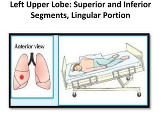 Chest physiotherapy, | PPT