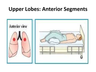 Chest physiotherapy, | PPT