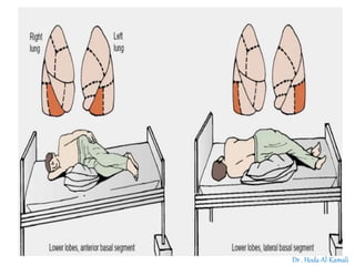 chest physiotherapy for nursing students.pptx