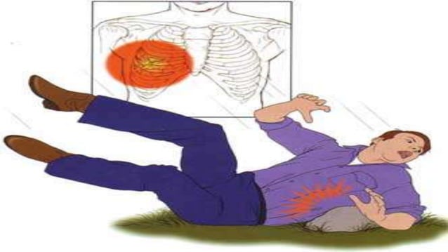 Chest physiotherapy by Miss Akanxa Rao (Mental Health Department) | PPT