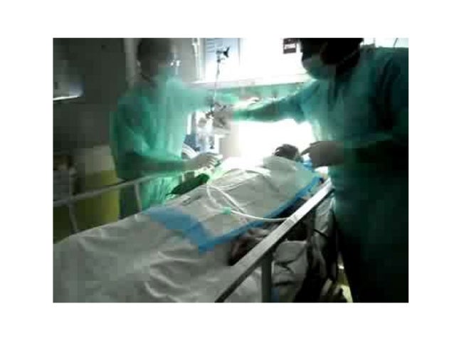 Chest physiotherapy in ICU