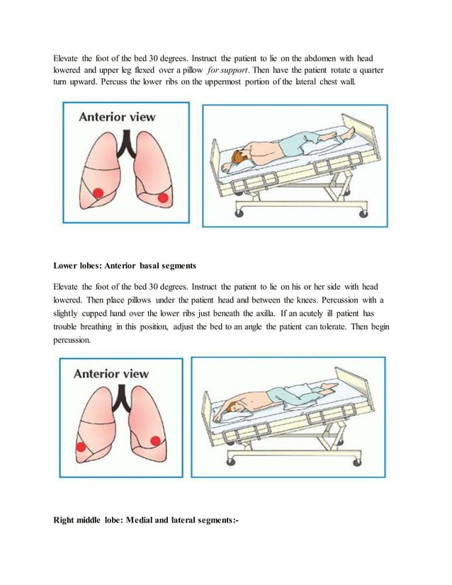 Chest physiotherapy procedure | DOCX | First Aid | Injuries