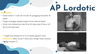 Chest Positioning Radiology (Belajar bersama).pptx