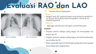 Chest Positioning Radiology (Belajar bersama).pptx