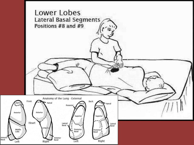 CHEST PHYSIOTHERAPY & POSTURAL DRAINAGE | PPTX | Physical Therapy ...