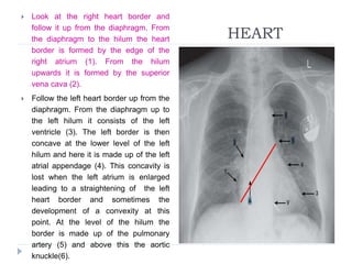 Chest radiograph | PPTX