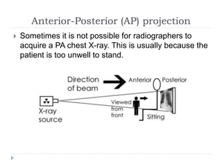 Chest radiograph | PPTX
