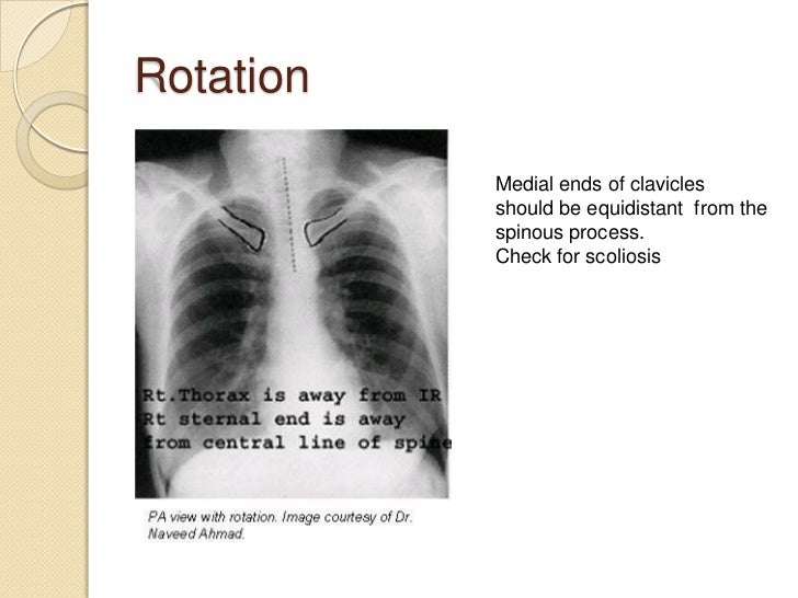 Chest radiography introduction