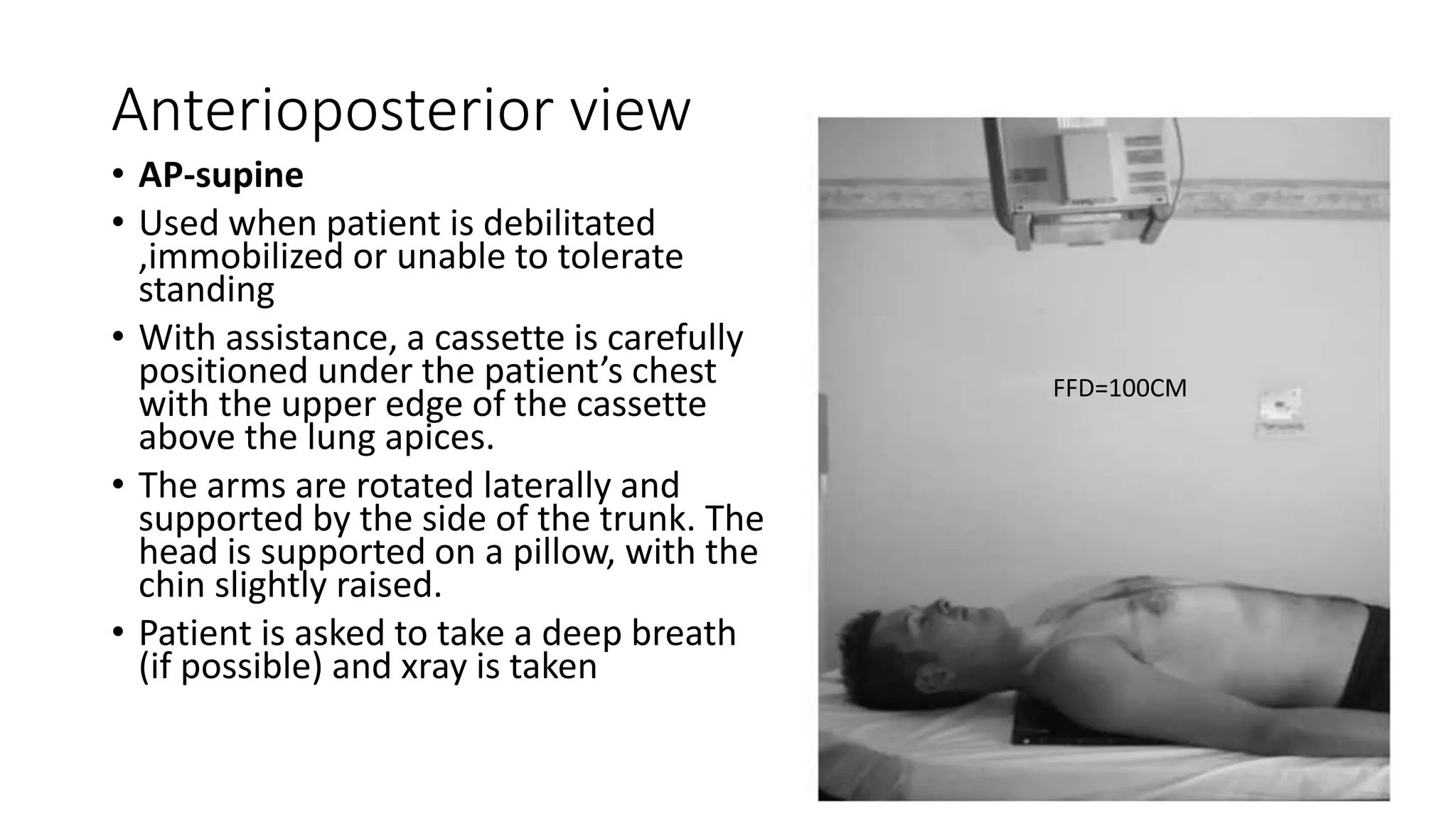 Chest radiography positioning and Technique.pptx
