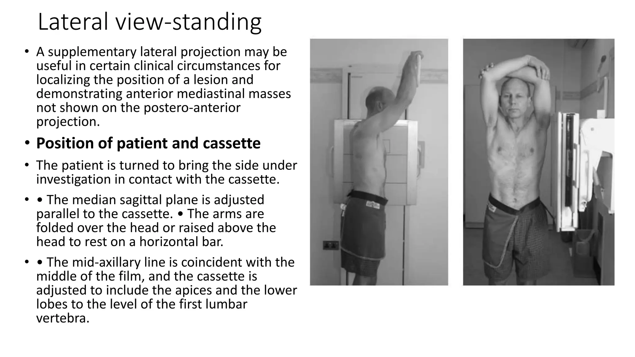 Chest radiography positioning and Technique.pptx