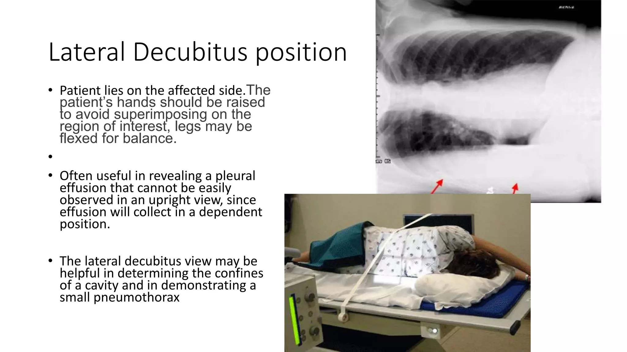 Chest radiography positioning and Technique.pptx