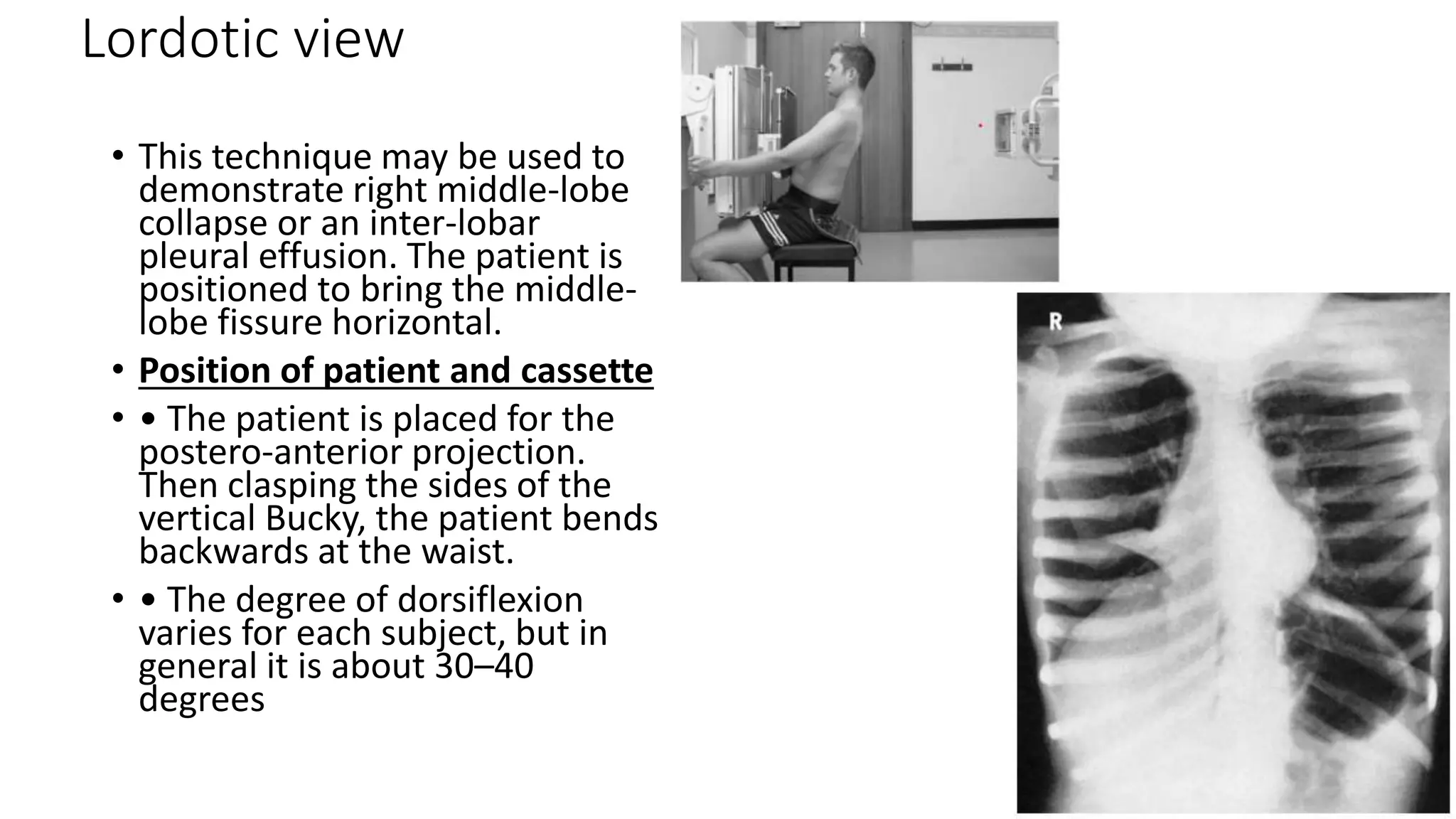 Chest radiography positioning and Technique.pptx