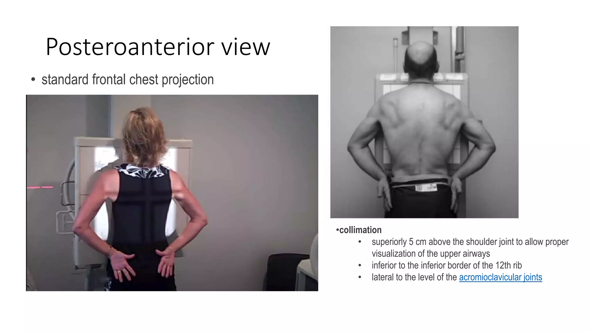 Chest radiography positioning and Technique.pptx