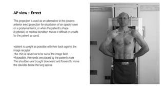 Chest radiography positioning and Technique.pptx