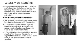 Chest radiography positioning and Technique.pptx
