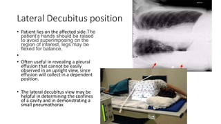Chest radiography positioning and Technique.pptx