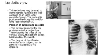 Chest radiography positioning and Technique.pptx