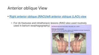 Chest radiography positioning and Technique.pptx