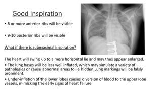Chest radiography positioning and Technique.pptx