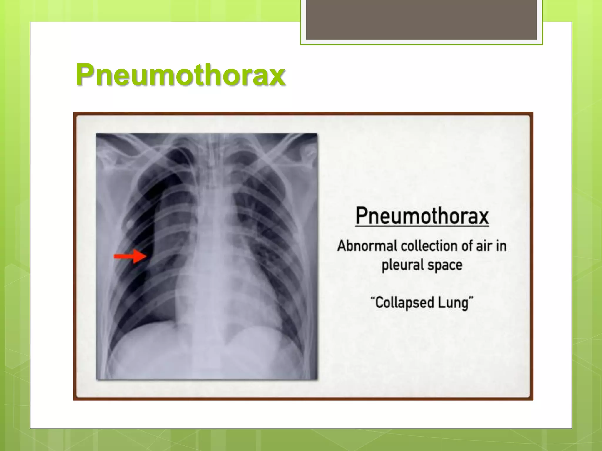 CHEST RADIOGRAPHY - Routine & special radiographs | PPTX