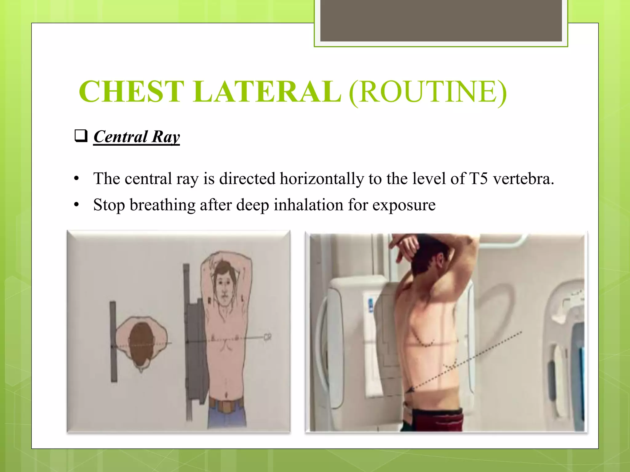 CHEST RADIOGRAPHY - Routine & special radiographs | PPTX