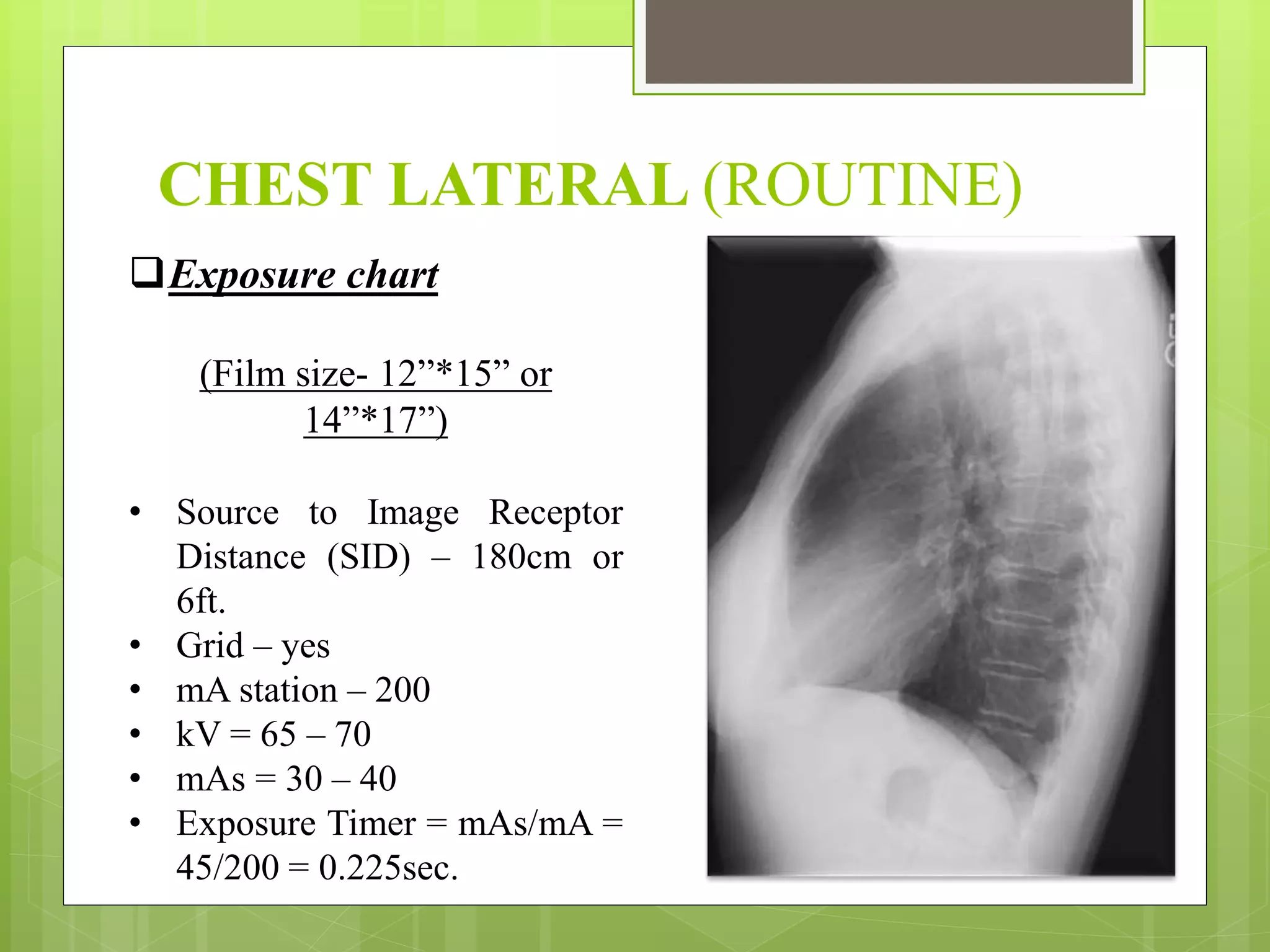 CHEST RADIOGRAPHY - Routine & special radiographs | PPTX