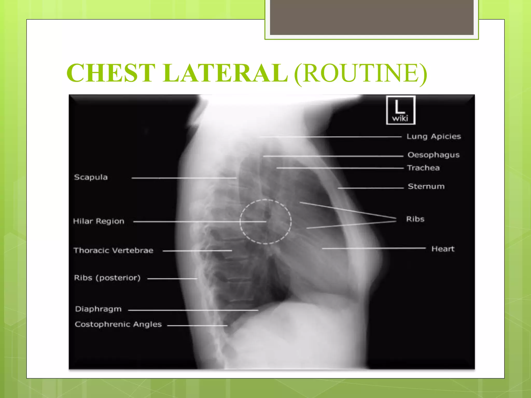 CHEST RADIOGRAPHY - Routine & special radiographs | PPTX