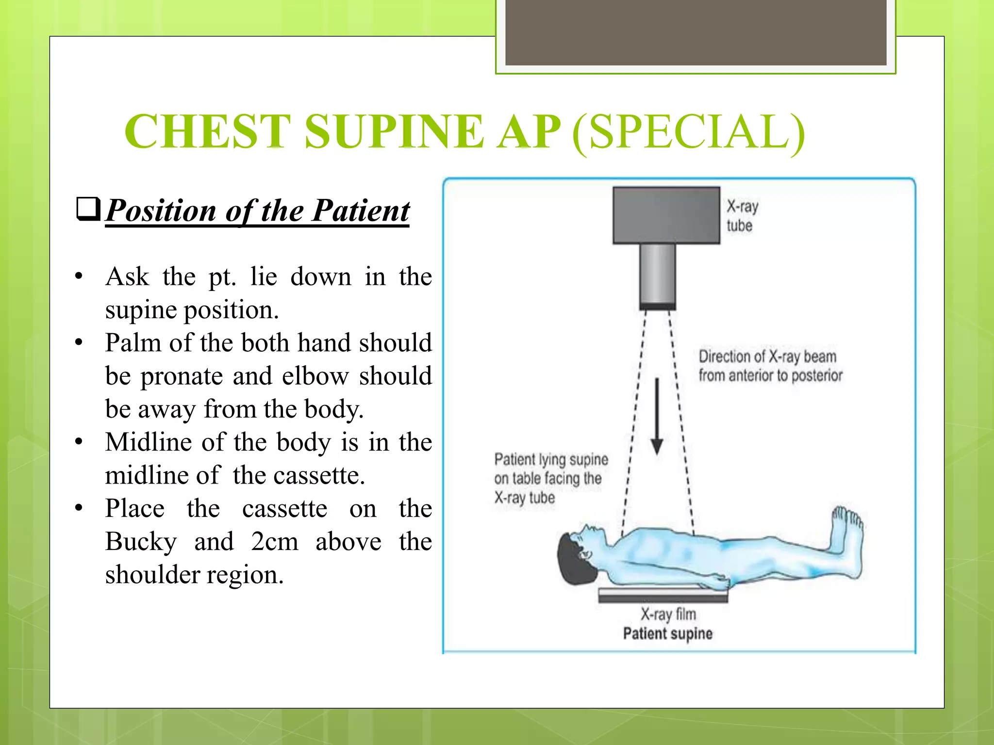 CHEST RADIOGRAPHY - Routine & special radiographs | PPTX