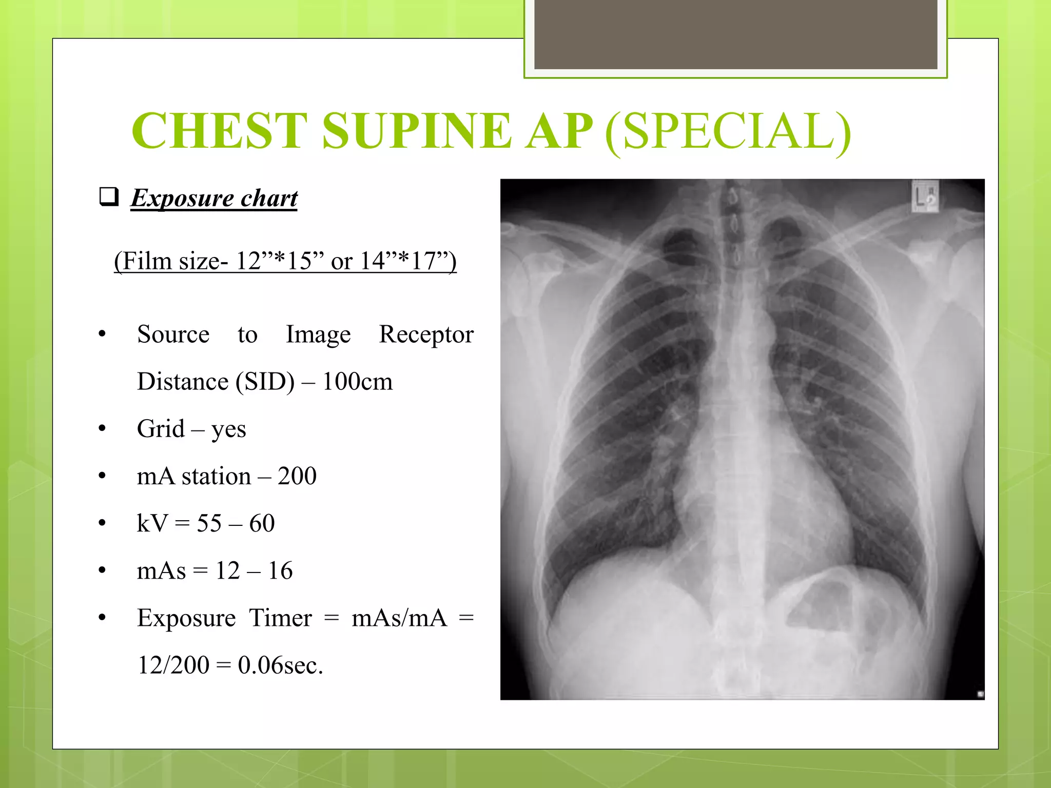 CHEST RADIOGRAPHY - Routine & special radiographs | PPTX