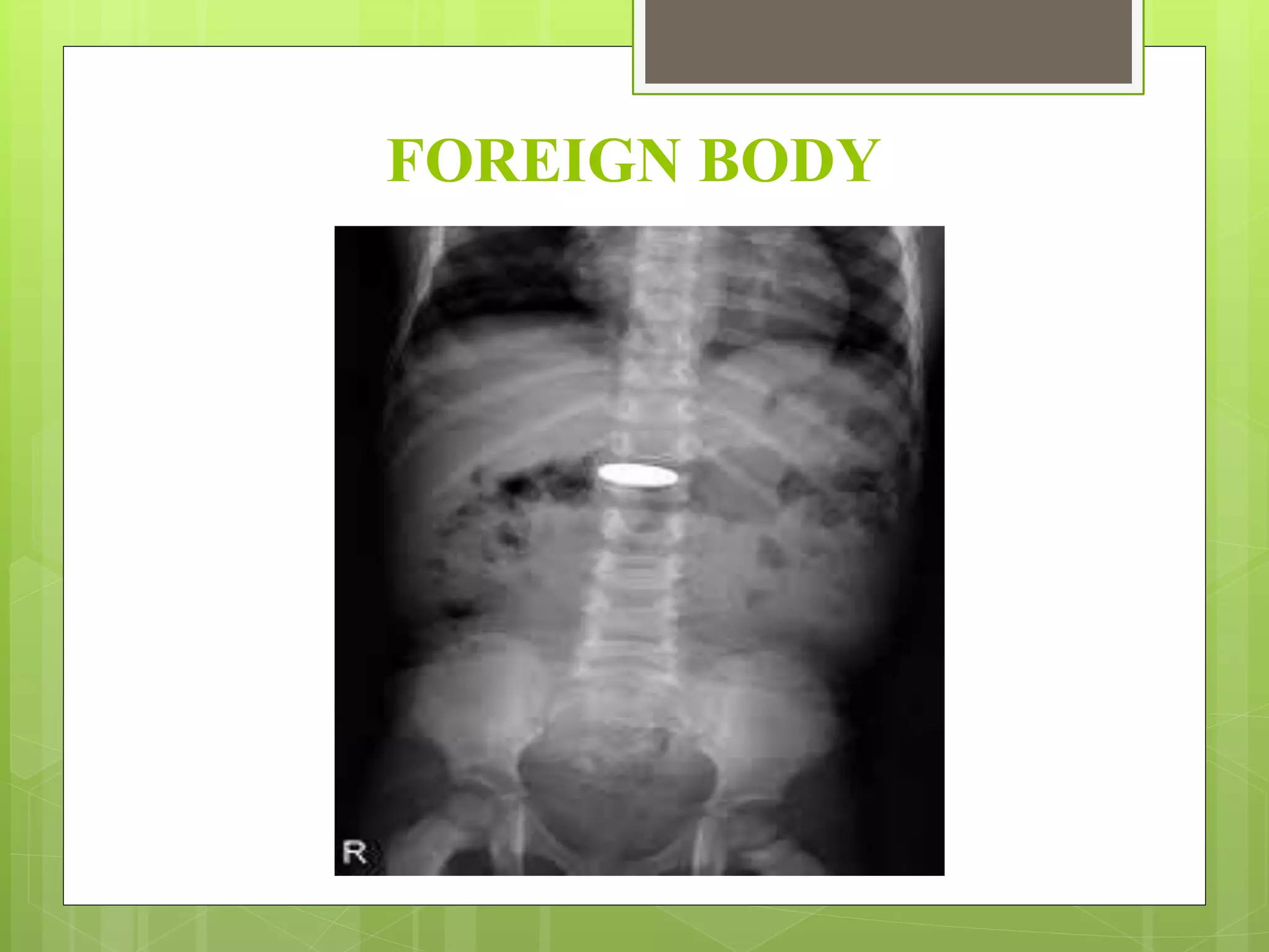 CHEST RADIOGRAPHY - Routine & special radiographs | PPTX