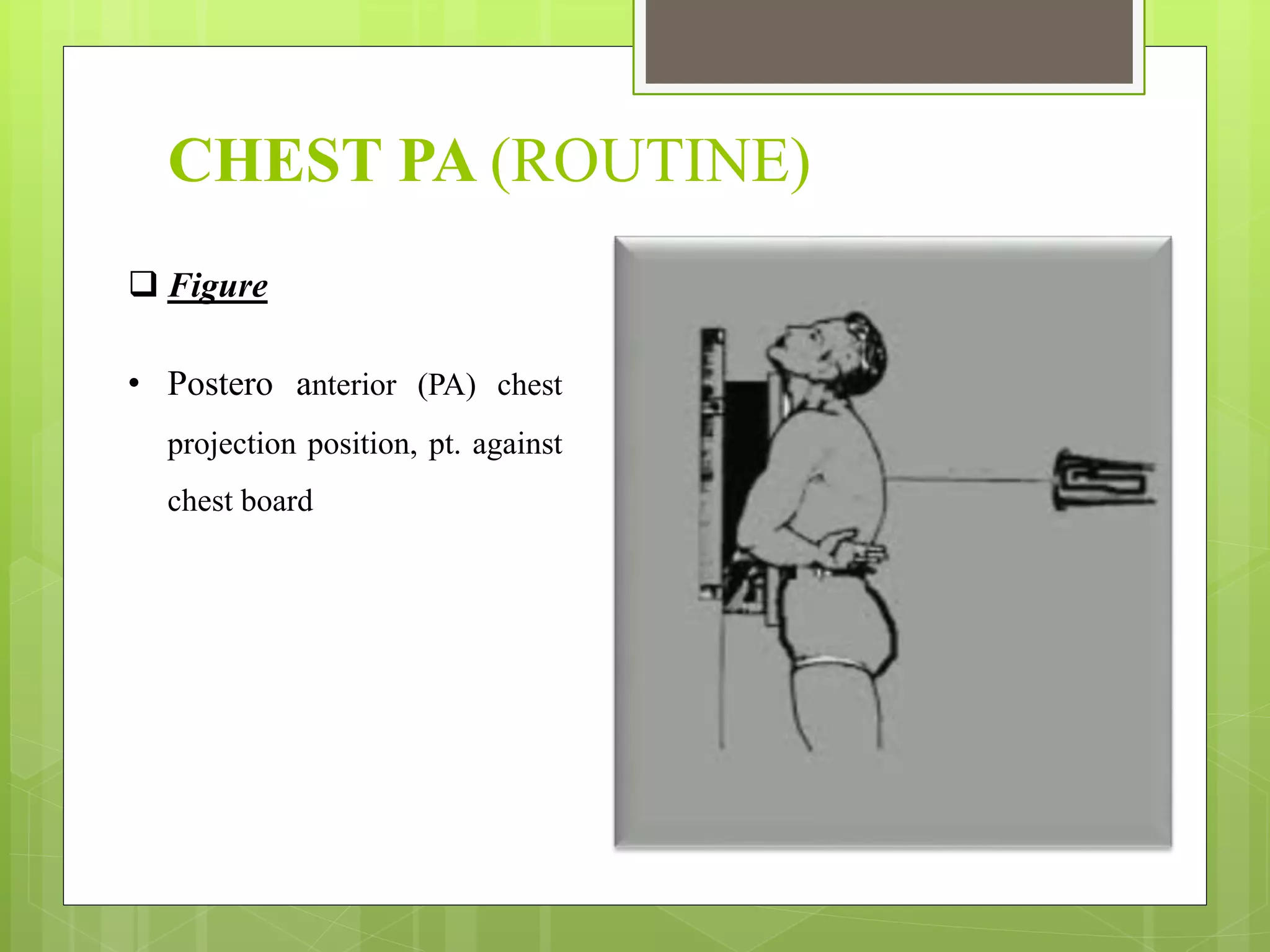 CHEST RADIOGRAPHY - Routine & special radiographs | PPTX