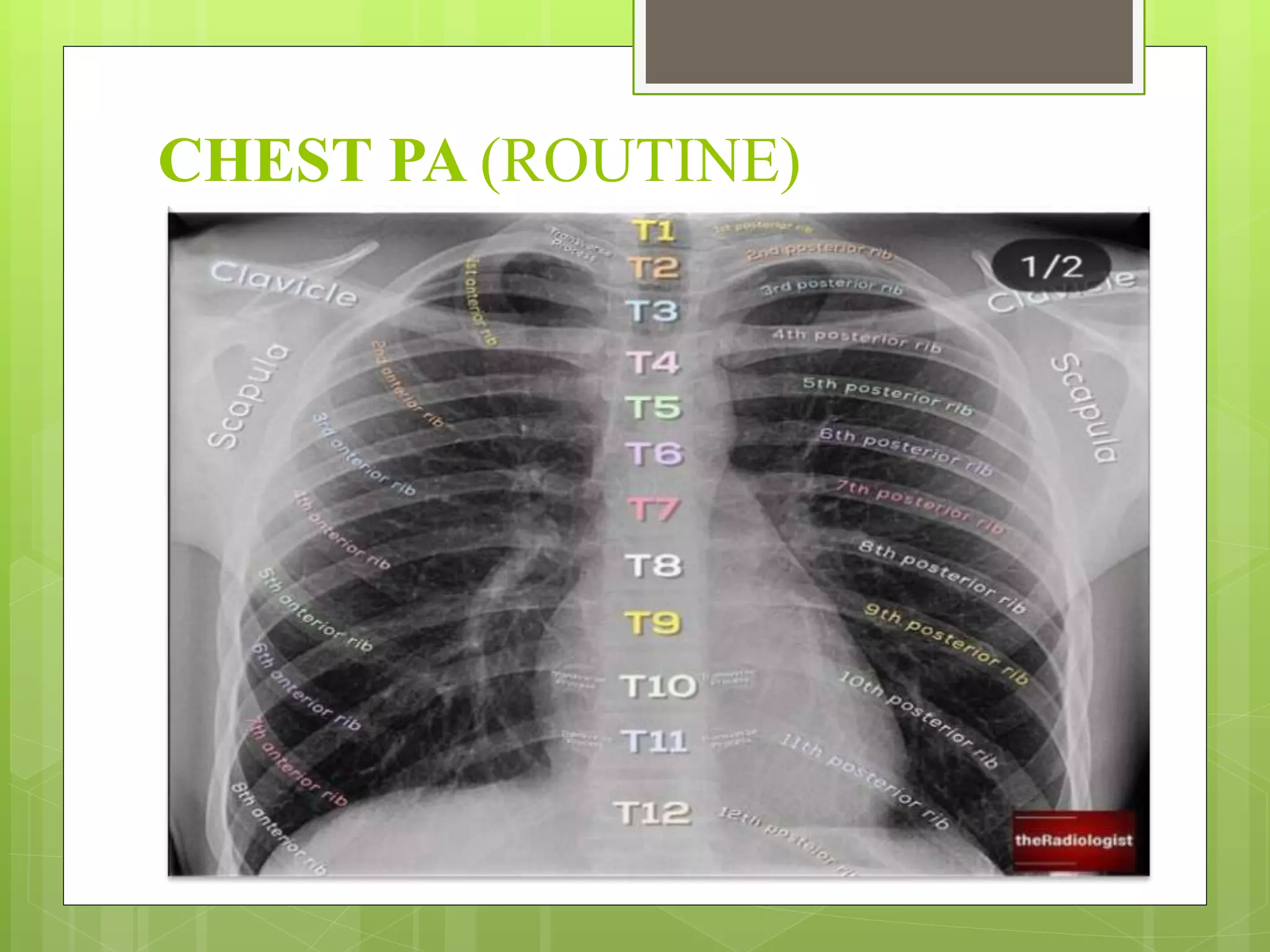 CHEST RADIOGRAPHY - Routine & special radiographs | PPTX
