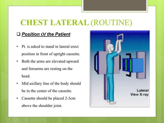 CHEST RADIOGRAPHY - Routine & special radiographs | PPTX