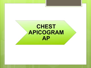 CHEST RADIOGRAPHY - Routine & special radiographs | PPTX