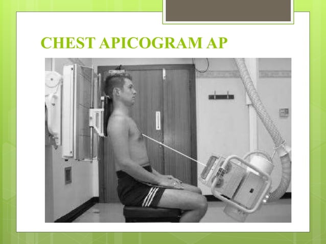 CHEST RADIOGRAPHY - Routine & special radiographs | PPTX