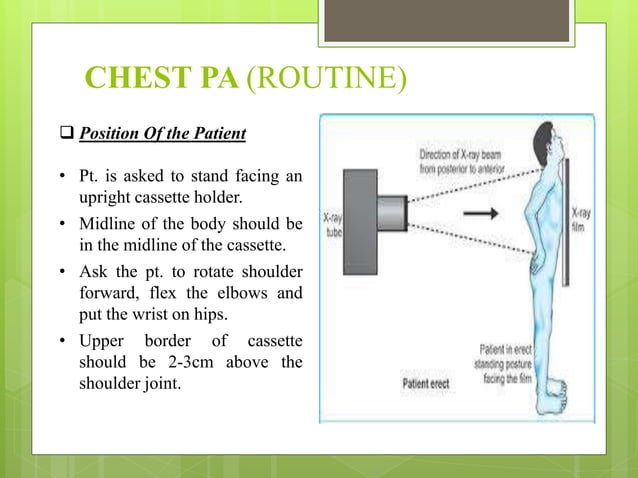 CHEST RADIOGRAPHY - Routine & special radiographs | PPTX